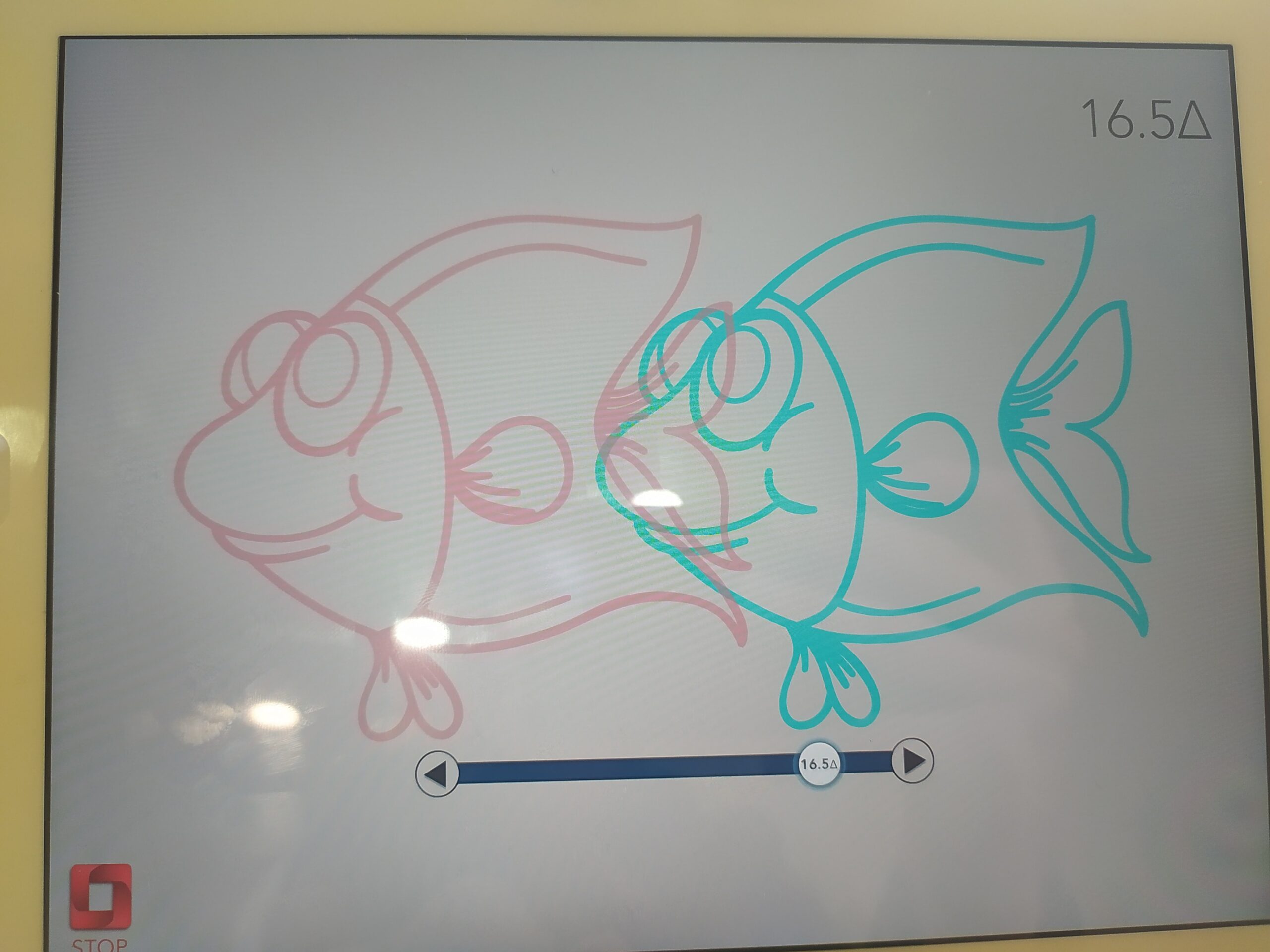 🟣 ¿Cómo corregir la VISIÓN DOBLE? ¿Ejercicios para la DIPLOPÍA?